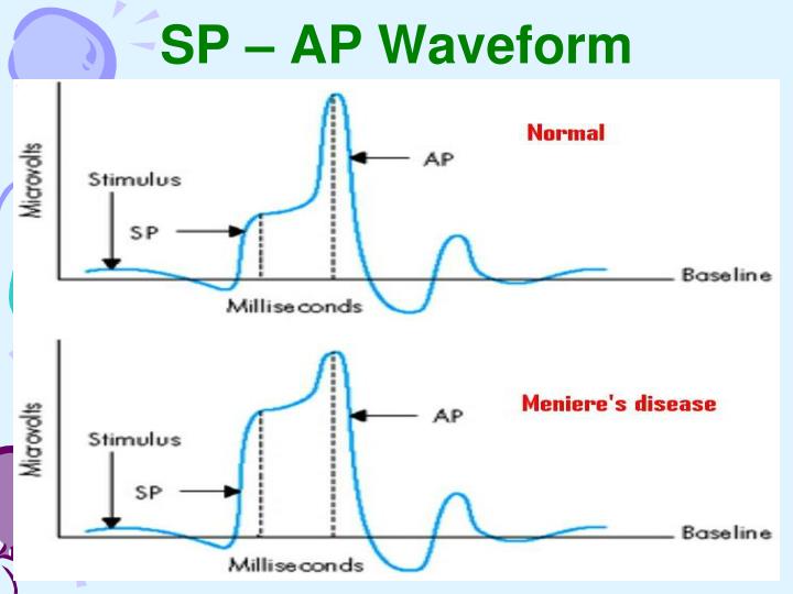 PPT - Audiometry PowerPoint Presentation - ID:6912897