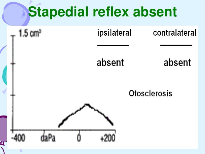 PPT - Audiometry PowerPoint Presentation - ID:6912897