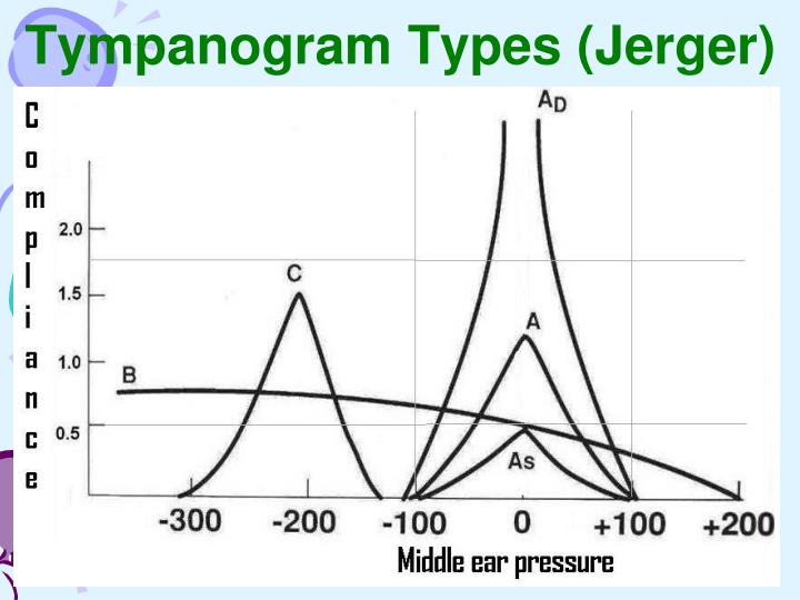 PPT - Audiometry PowerPoint Presentation - ID:6912897