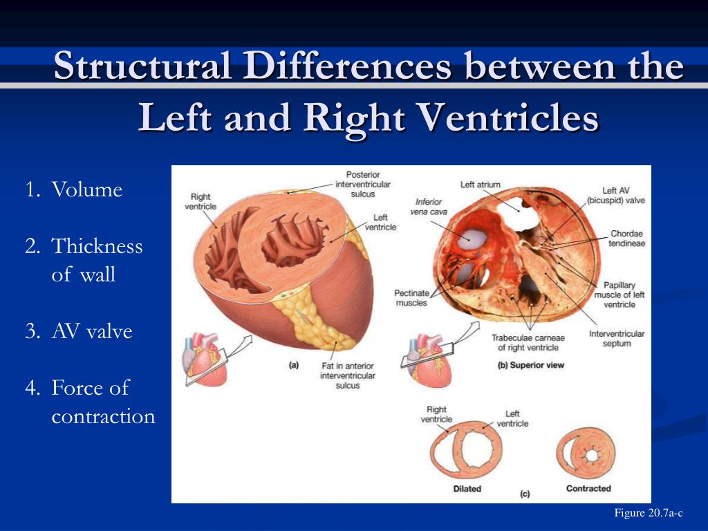 What Is The Difference Between Left Ventricle And Right Ventricle Images What Is The Difference Between Left Ventricle And Right Ventricle Images