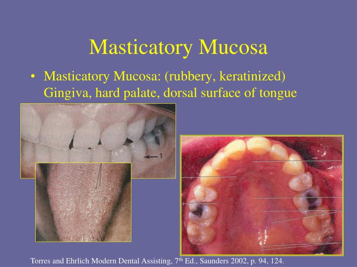 PPT - Oral Mucosa DHY114 – Week 1 PowerPoint Presentation - ID:6929210