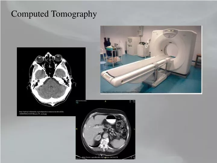 PPT - Computed Tomography PowerPoint Presentation, free download - ID ...