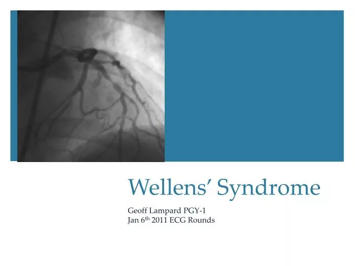 PPT - Wellens ’ Syndrome PowerPoint Presentation, free download - ID ...