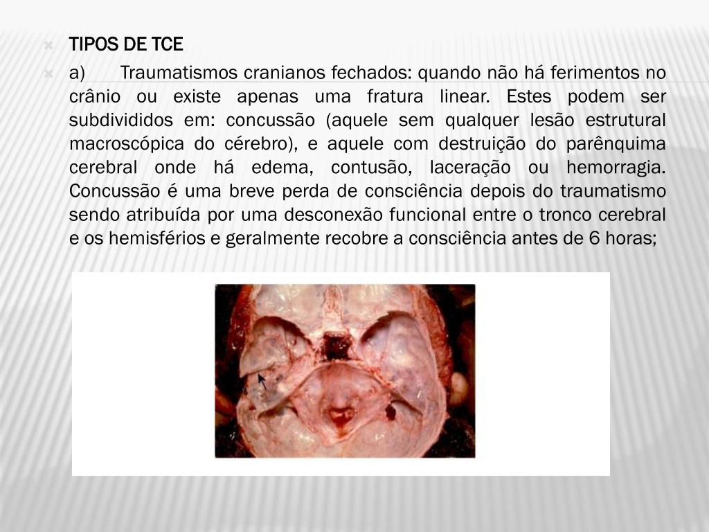 PPT - O PACIENTE NEUROCRÍTICO NA UNIDADE INTENSIVA DE TRATAMENTO ...