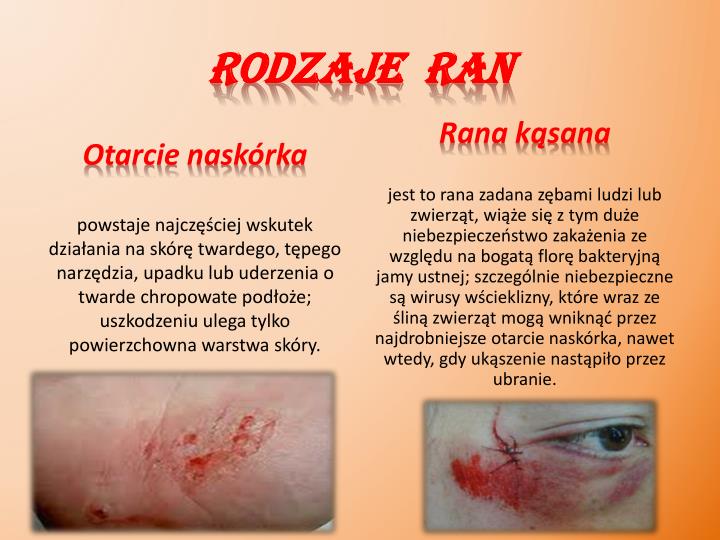 PPT - Rany PowerPoint Presentation - ID:6945130