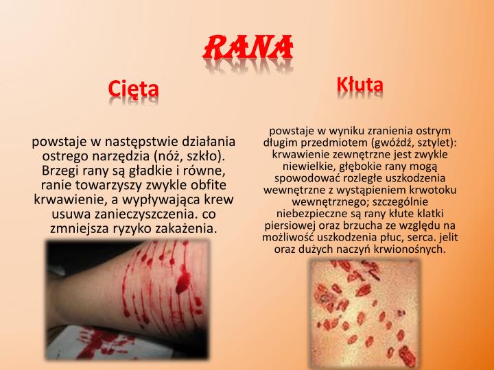 PPT - Rany PowerPoint Presentation - ID:6945130