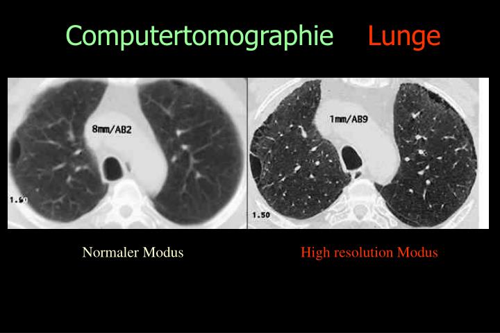 PPT - Thoraxtrauma PowerPoint Presentation - ID:6947283