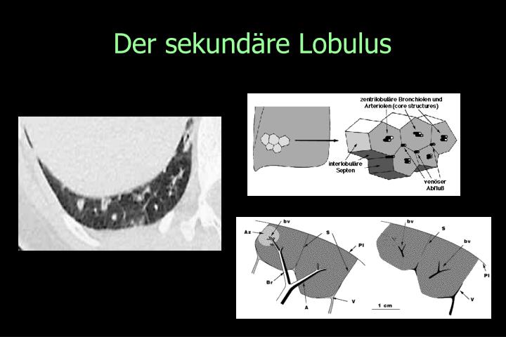 PPT - Thoraxtrauma PowerPoint Presentation - ID:6947283