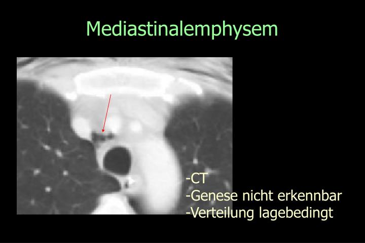 PPT - Thoraxtrauma PowerPoint Presentation - ID:6947283