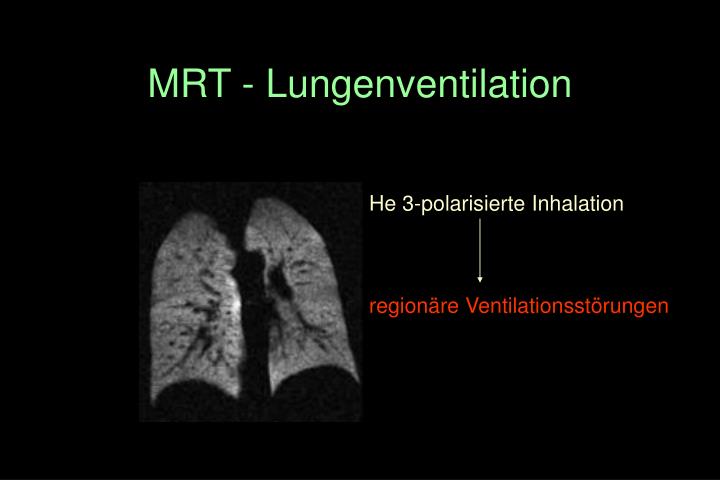 PPT - Thoraxtrauma PowerPoint Presentation - ID:6947283