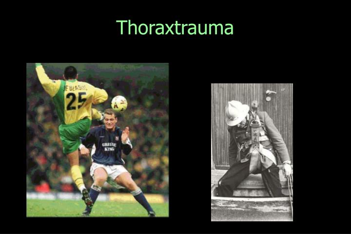 PPT - Thoraxtrauma PowerPoint Presentation - ID:6947283