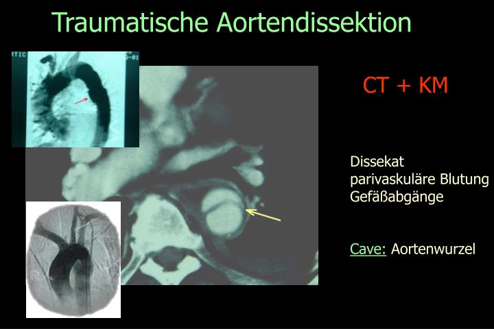 PPT - Thoraxtrauma PowerPoint Presentation - ID:6947283