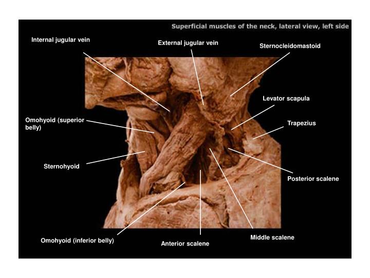 PPT - Levator labii superioris PowerPoint Presentation - ID:6948875