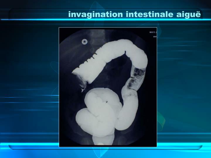 PPT - CHIRURGIE PEDIATRIQUE PowerPoint Presentation - ID:6957131