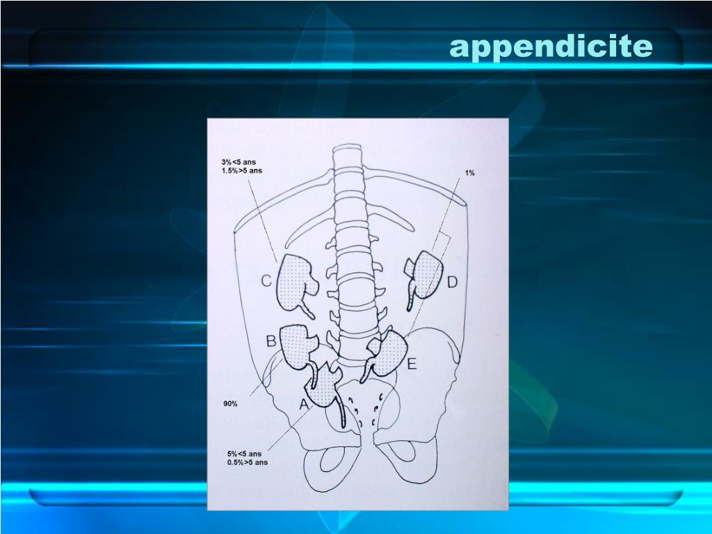 PPT - CHIRURGIE PEDIATRIQUE PowerPoint Presentation, free download - ID ...