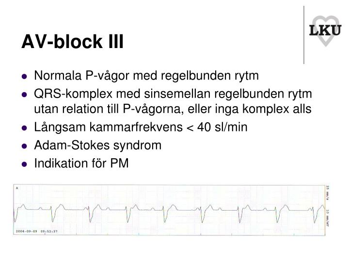 PPT - EKG PowerPoint Presentation - ID:6957916