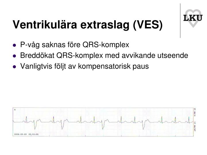 PPT - EKG PowerPoint Presentation - ID:6957916