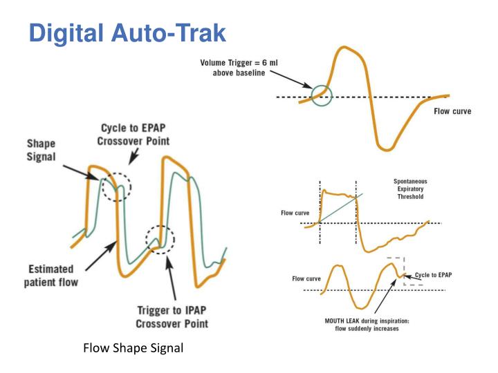 PPT - Patient - Ventilator Asynchrony in Non - invasive Ventilation and ...