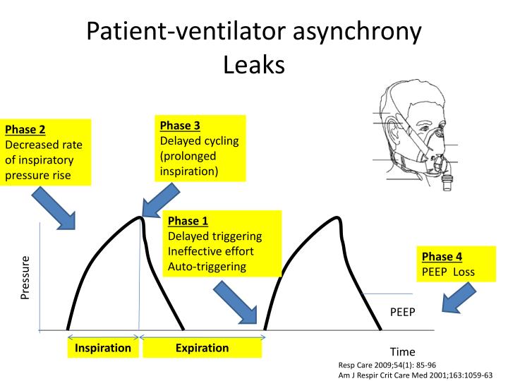 PPT - Patient - Ventilator Asynchrony in Non - invasive Ventilation and ...