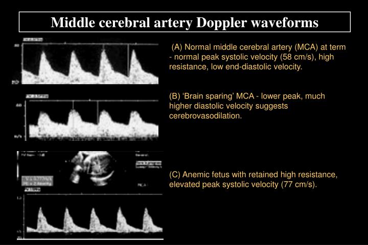 PPT - Doppler Ultrasonography in Obstetrical Practice PowerPoint ...