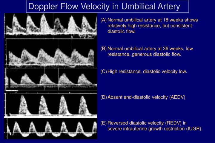 PPT - Doppler Ultrasonography in Obstetrical Practice PowerPoint ...