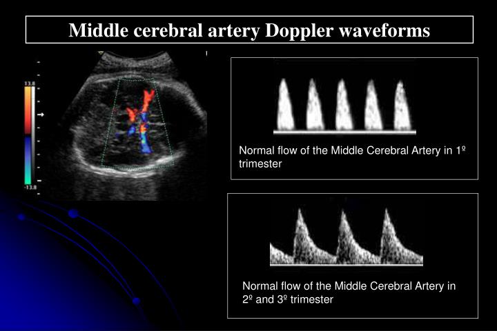 PPT - Doppler Ultrasonography in Obstetrical Practice PowerPoint ...