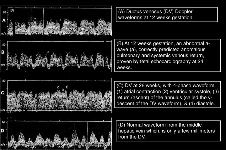 PPT - Doppler Ultrasonography in Obstetrical Practice PowerPoint ...