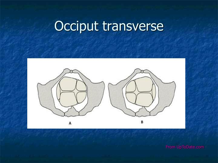 PPT - Mechanisms and Management of Labor PowerPoint Presentation - ID ...