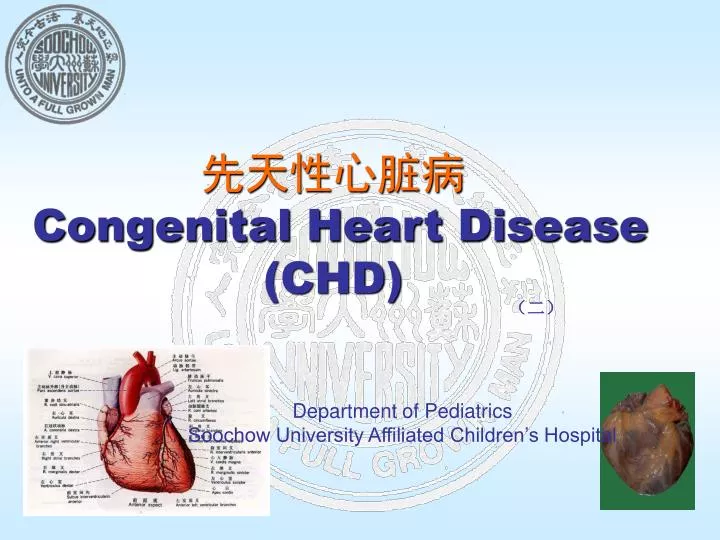 PPT - 先天性心脏病 Congenital Heart Disease (CHD) PowerPoint Presentation ...