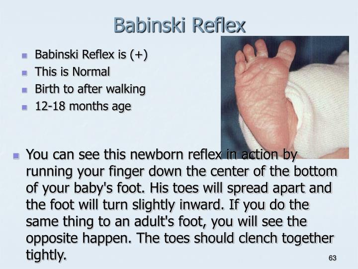 PPT - Newborn Nursing PowerPoint Presentation - ID:6966884