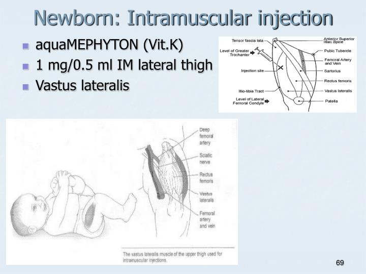 Ppt Newborn Nursing Powerpoint Presentation Id 6966884