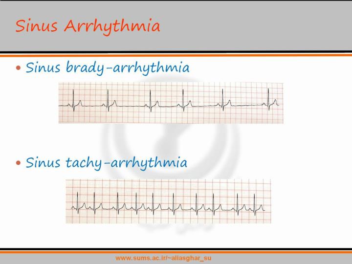 PPT - Rhythm Analysis PowerPoint Presentation - ID:6971486