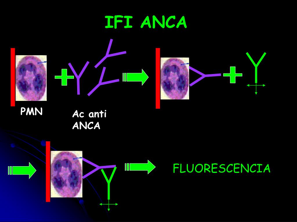 PPT - TECNICAS PARA DETECCIÓN DE ANCAS PowerPoint Presentation, free ...