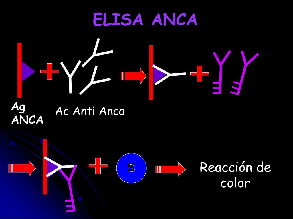 PPT - TECNICAS PARA DETECCIÓN DE ANCAS PowerPoint Presentation, free ...