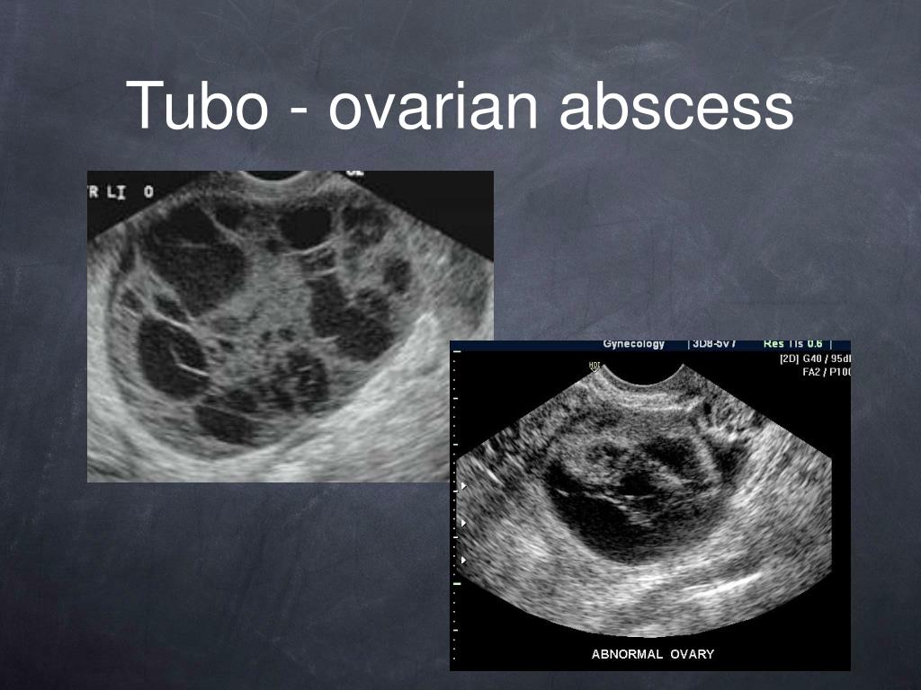 Ppt Pelvic Ultrasound Powerpoint Presentation Free Download Id 6977515