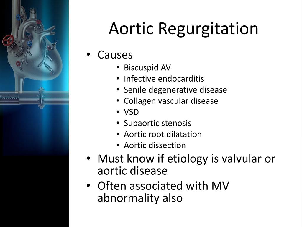 Aortic Regurgitation Causes Symptoms Diagnosis And Tr - vrogue.co Aortic Regurgitation Causes Symptoms Diagnosis And Tr - vrogue.co