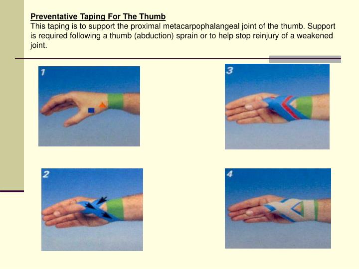 PPT - Strapping for sports injuries PowerPoint Presentation - ID:6991005