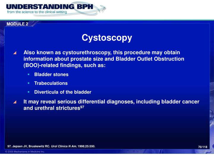 PPT - Module 2: Diagnosis of BPH PowerPoint Presentation - ID:6996320