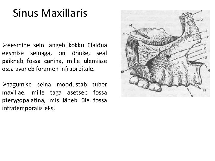 PPT - Sinuiit PowerPoint Presentation - ID:6997038