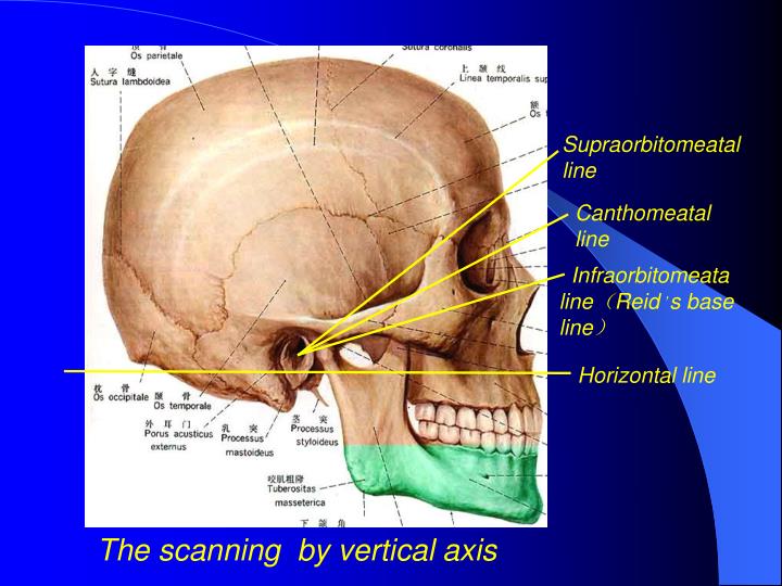 PPT - The introduction of sectional anatomy PowerPoint Presentation ...