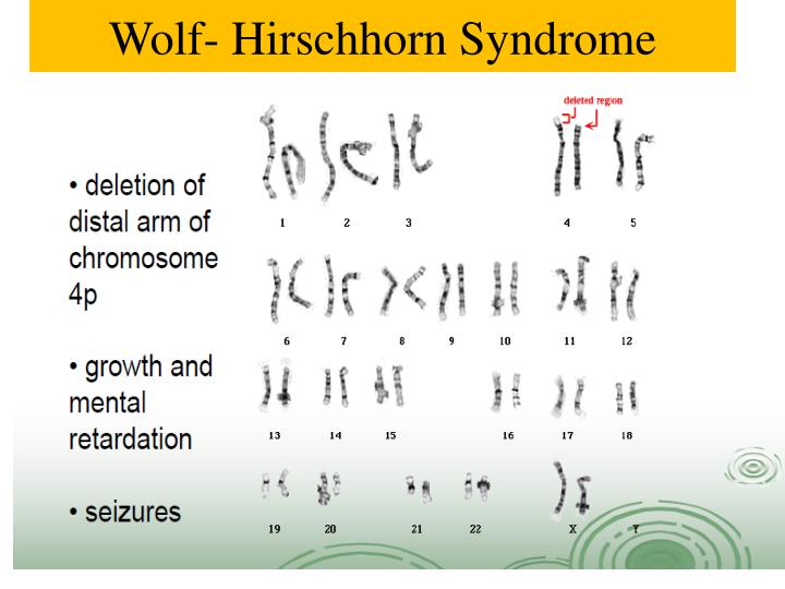 PPT - Chromosomal Abnormalities II SDK October 28, 2013 PowerPoint ...