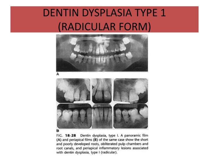 PPT - DENTAL ANOMALY PowerPoint Presentation - ID:7007534