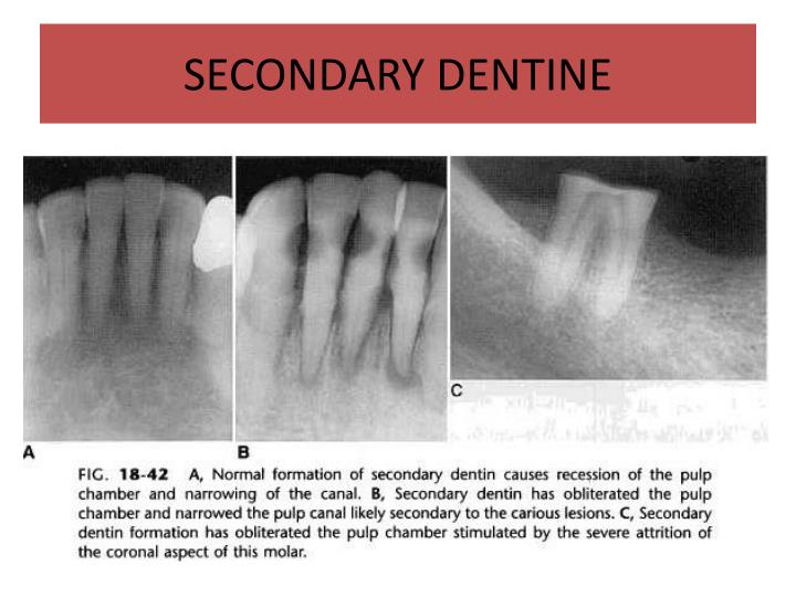 PPT - DENTAL ANOMALY PowerPoint Presentation - ID:7007534