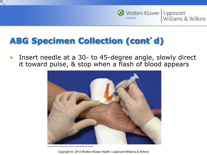 PPT - Chapter 14: Arterial Puncture Procedures PowerPoint Presentation ...