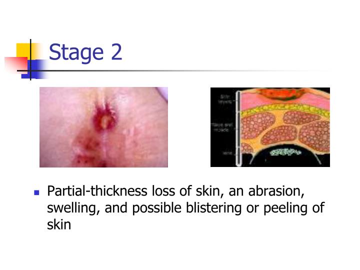 PPT - How Nutrition Plays a Role in Wound Healing PowerPoint ...