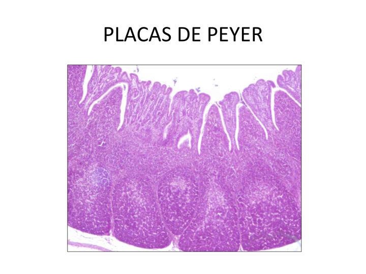 3d Illustration Peyers Patches Lymphoid Tissue Stock Illustration ...