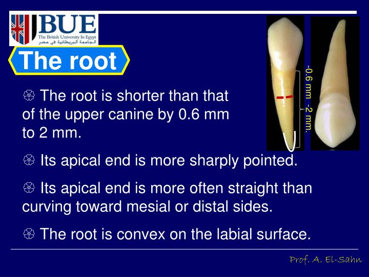 PPT - MANDIBULAR CANINE PowerPoint Presentation - ID:7024933