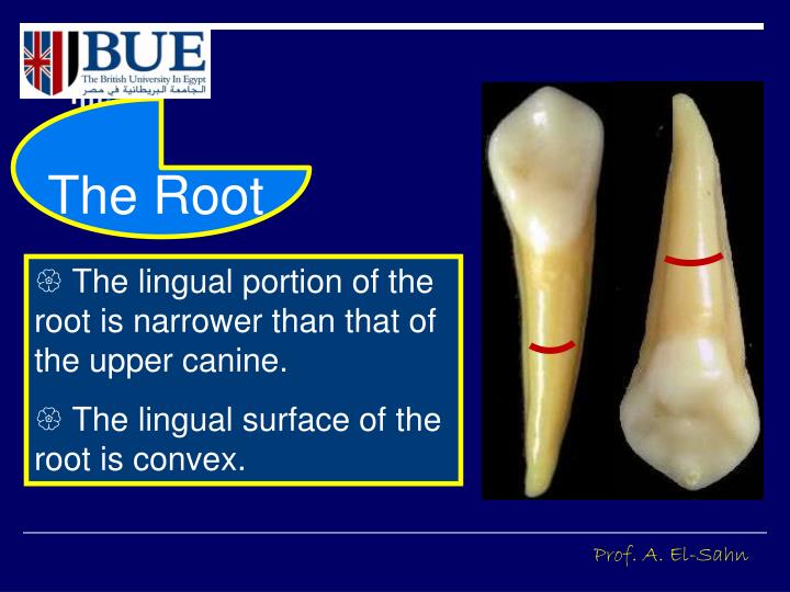 PPT - MANDIBULAR CANINE PowerPoint Presentation - ID:7024933