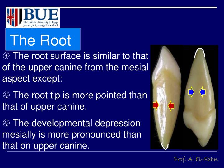 PPT - MANDIBULAR CANINE PowerPoint Presentation - ID:7024933
