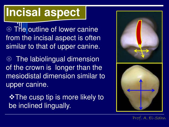 PPT - MANDIBULAR CANINE PowerPoint Presentation - ID:7024933